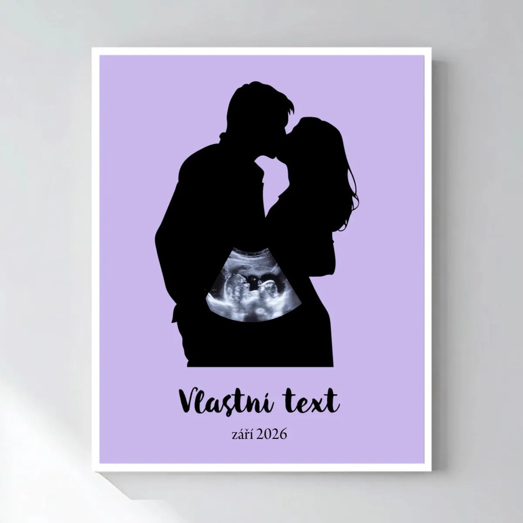 Personalizovaný magický fotoobraz v rámu - čtverec 40x50 - s párem a ultrazvukem