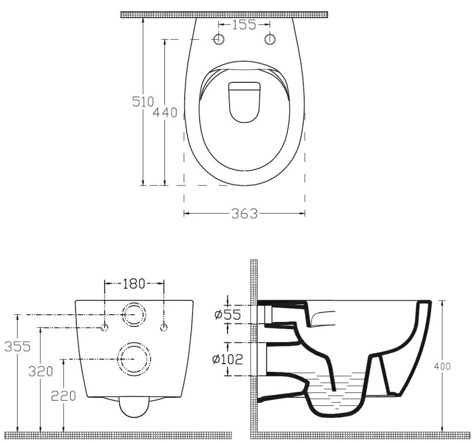 Sapho Závěsné WC SENTIMENTI Rimless s podomítkovou nádržkou a tlačítkem Schwab, bílá 10AR02010SV-SET5