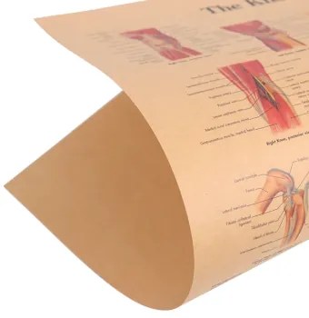 Plakát Anatomie člověka, koleno, č.296, 42 x 30 cm