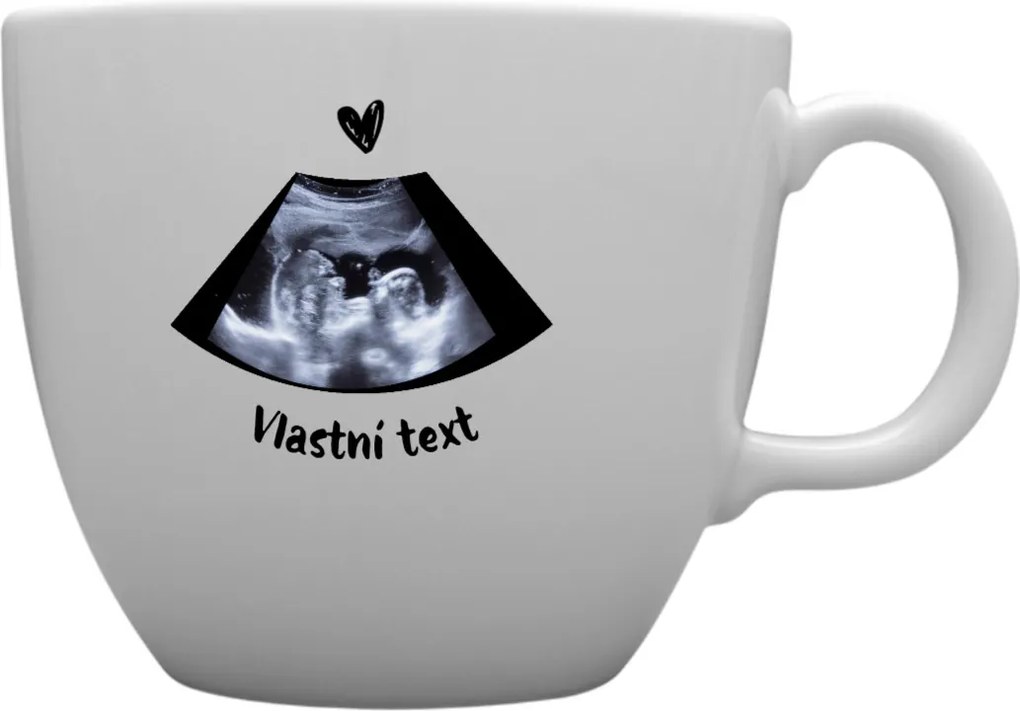Personalizovaný MEGA XXL keramický hrnek 1 000 ml s ultrazvukem