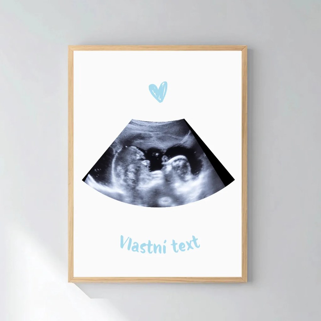 Personalizovaný magický fotoobraz v rámu - 30x40 - ultrazvuk