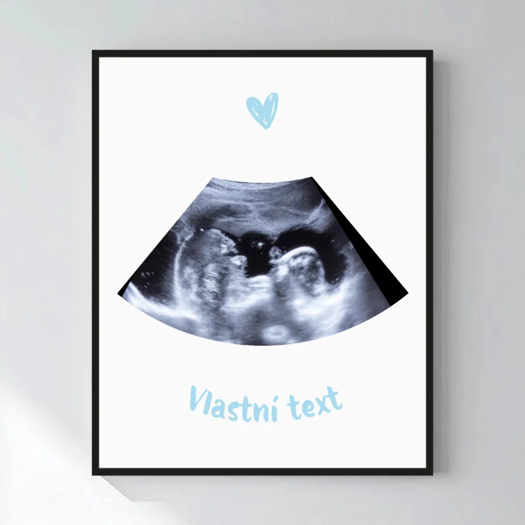 Personalizovaný magický fotoobraz v rámu - 40x50 - ultrazvuk