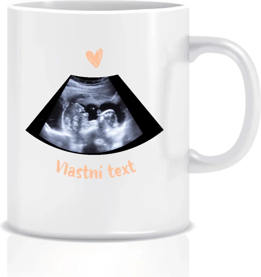 Personalizovaný klasický bílý keramický hrníček 300 ml s ultrazvukem