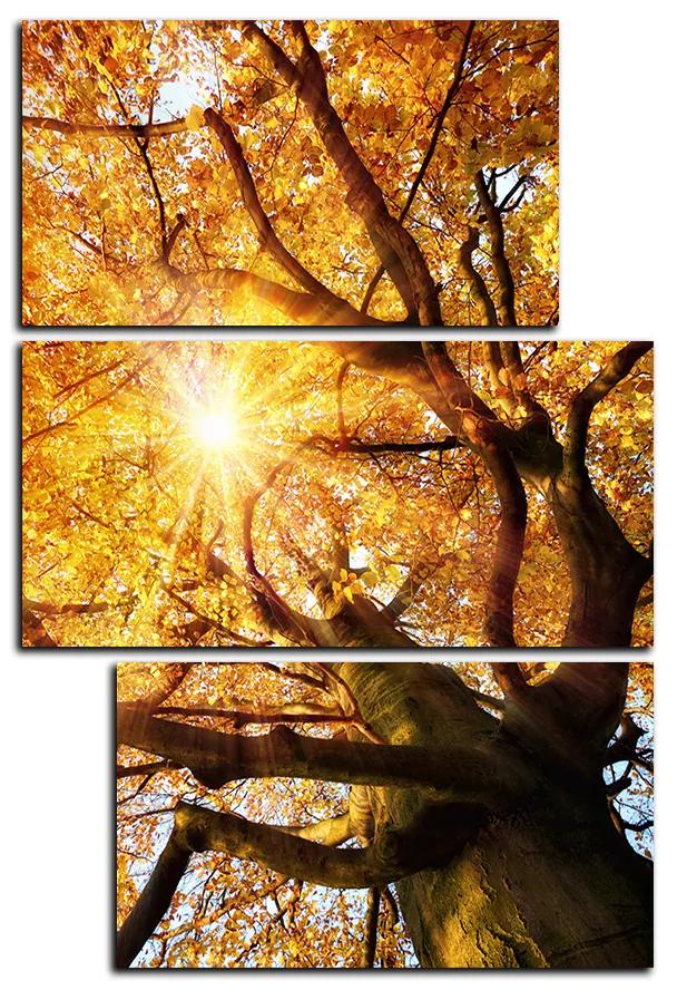 Obraz na plátně - Slunce přes větve stromu - obdélník 7240D (90x60 cm)