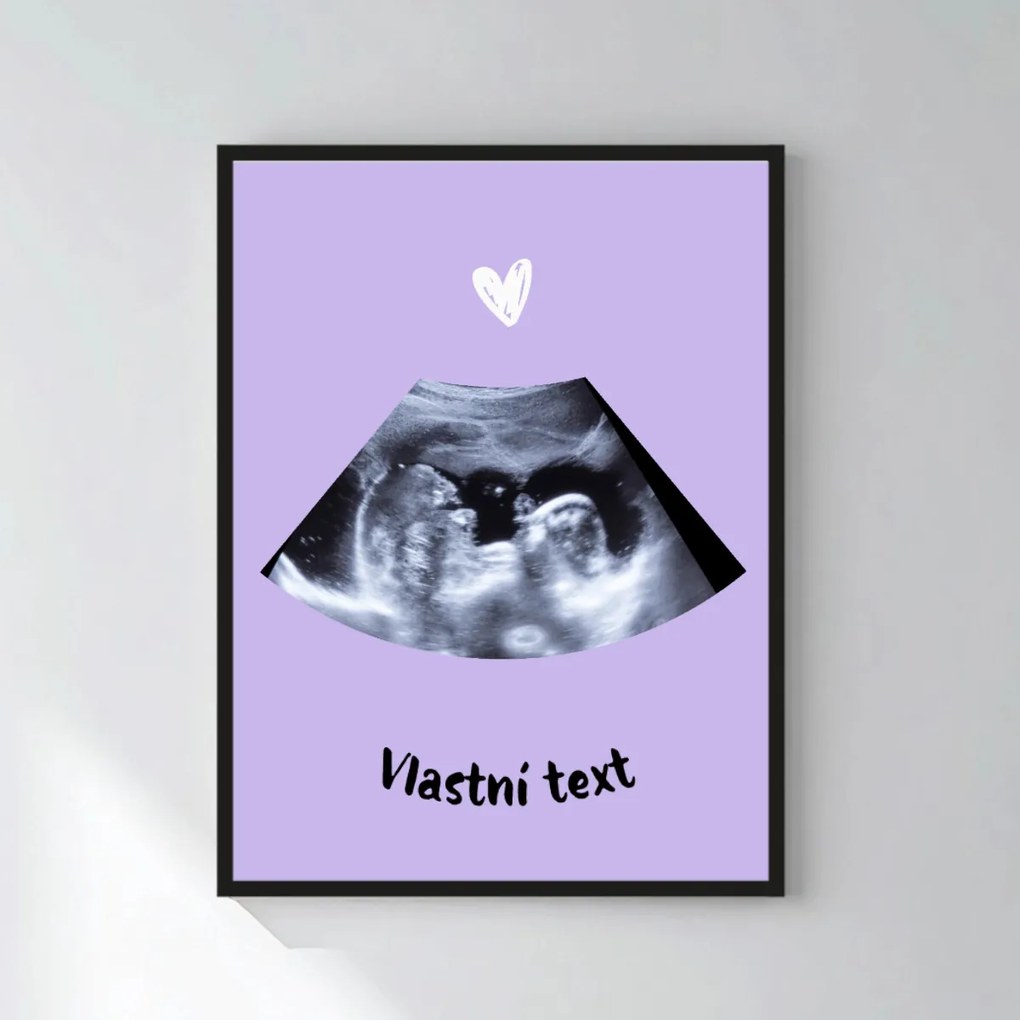 Personalizovaný magický fotoobraz v rámu - 30x40 - ultrazvuk
