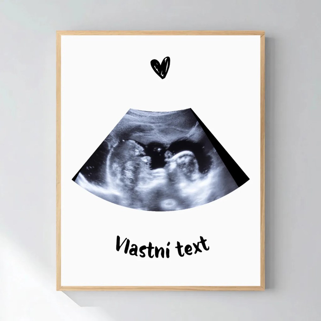 Personalizovaný magický fotoobraz v rámu - 50x70 - ultrazvuk