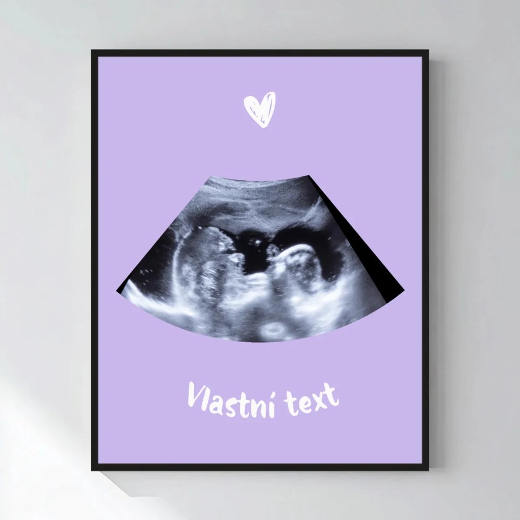 Personalizovaný magický fotoobraz v rámu - 50x70 - ultrazvuk
