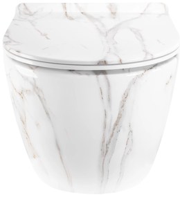 Rea Carter Tornado, závěsná WC mísa 49x37x35 cm + WC sedátko, imitace kamene-Aiax Shiny, REA-C6390