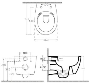 Sapho Závěsné WC SENTIMENTI Rimless s podomítkovou nádržkou a tlačítkem Schwab, bílá 10AR02010SV-SET5
