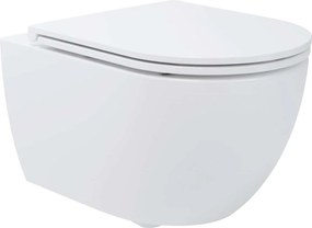 kielle Oudee - Závěsné WC se sedátkem Softclose, Vortex Rimless+, bílá 30102020-SET1