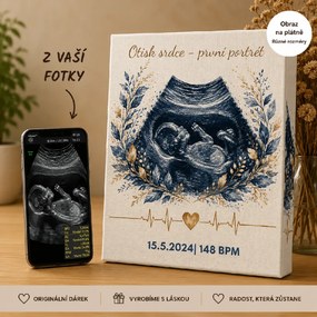 Foto obraz z ultrazvuku na plátno – Otisk srdce a EKG křivka – Originální památka Rozměry obrazu: 40 x 50 cm