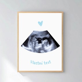 Personalizovaný magický fotoobraz v rámu - 30x40 - ultrazvuk