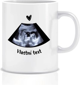 Personalizovaný klasický bílý keramický hrníček 300 ml s ultrazvukem