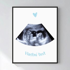 Personalizovaný magický fotoobraz v rámu - 40x50 - ultrazvuk