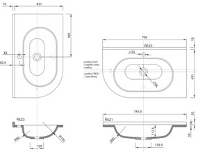Sapho - Rohové zápustné umyvadlo PULSE 75x43 cm mramor/bílá
