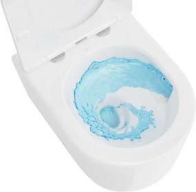 Mexen Sofia, závěsná WC mísa 490x360x355 mm, Rimless Tornádo + WC sedátko z duroplastu, bílá lesklá, 30540400T