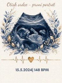 Foto obraz z ultrazvuku na plátno – Otisk srdce a EKG křivka – Originální památka