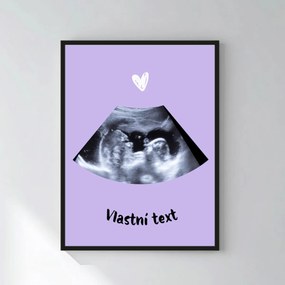 Personalizovaný magický fotoobraz v rámu - 30x40 - ultrazvuk