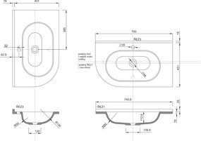 Sapho Sapho, PULSE litý mramor umyvadlo 75x45cm, pravé, bílé, BM658