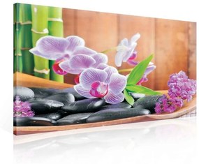 Postershop Obraz na plátně: Orchidej (1) - 75x100 cm