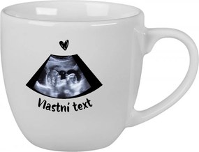 Personalizovaný keramický hrníček 400 ml s ultrazvukem