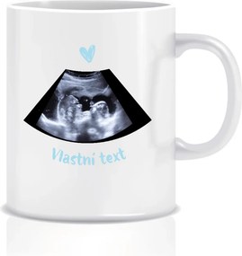 Personalizovaný klasický bílý keramický hrníček 300 ml s ultrazvukem
