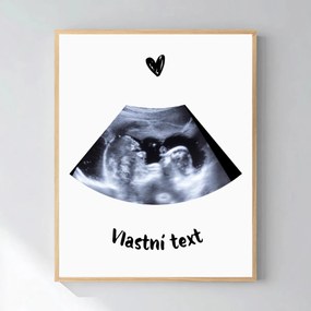 Personalizovaný magický fotoobraz v rámu - 50x70 - ultrazvuk