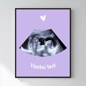 Personalizovaný magický fotoobraz v rámu - 50x70 - ultrazvuk